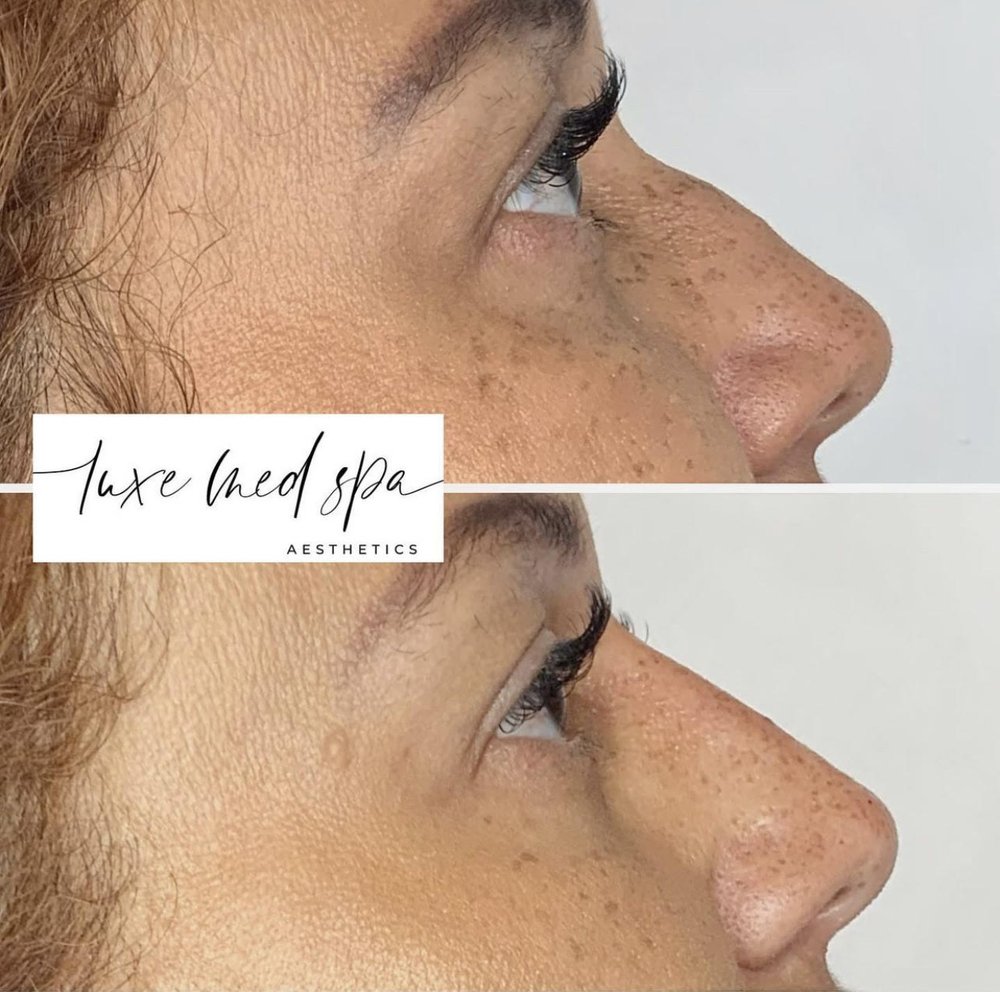 LUXE MED SPA AESTHETICS - Updated November 2024 - 35 Photos & 14 ...