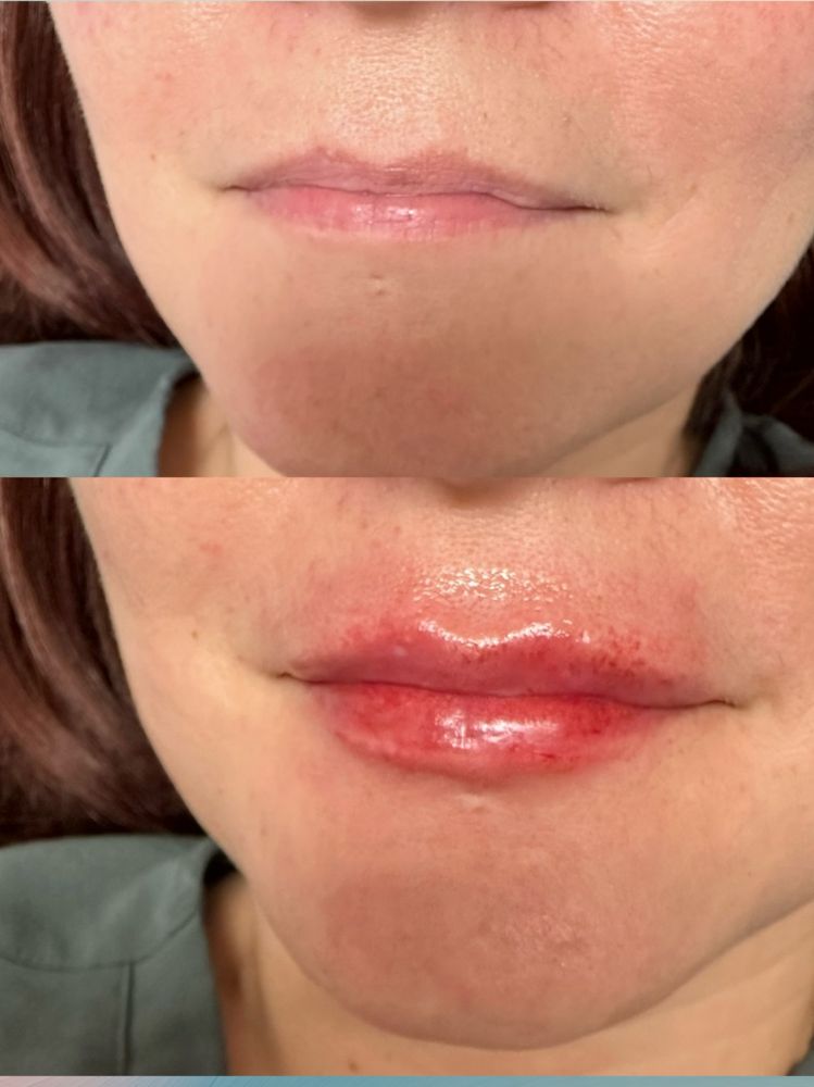 NUCELL SKIN MEDSPA - Updated October 2025 - 60 Photos & 41 Reviews ...