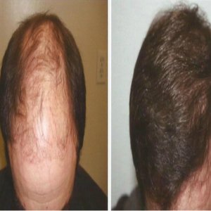 MEDICAL HAIR TRANSPLANT AND AESTHETICS - 121 Photos & 64 Reviews - Hair ...