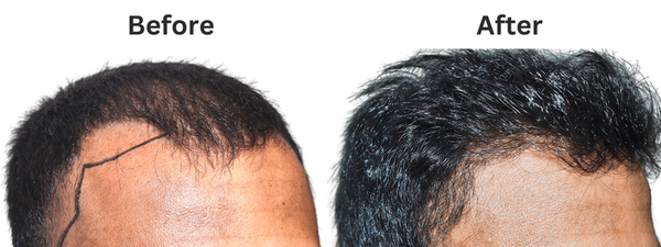 MAXIM HAIR RESTORATION - Updated July 2025 - 811 Trinity St, Austin ...