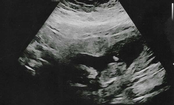 REPRODUCTIVE SCIENCE CENTER - Updated December 2025 - 28 Photos & 174 ...