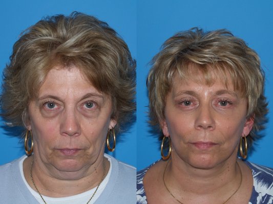 THE CHOE CENTER FOR FACIAL PLASTIC SURGERY - Updated August 2025 - 15 ...