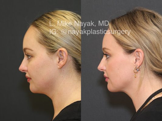 NAYAK PLASTIC SURGERY - Updated March 2025 - 266 Photos & 33 Reviews ...