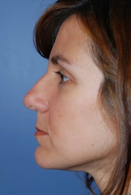 SAMUEL LIN, MD, FACS - Updated September 2025 - 30 Photos - 98 Binney ...