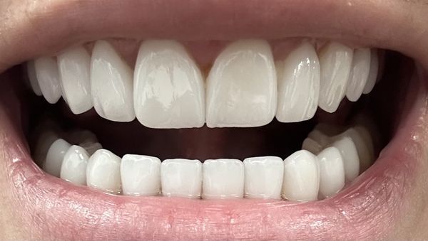 CG SMILE - Updated December 2024 - 55 Photos & 45 Reviews - 2601 SW ...