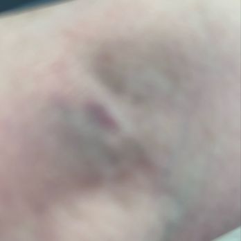 KAISER PERMANENTE TRACY MEDICAL OFFICES - Updated January 2026 - 84 ...