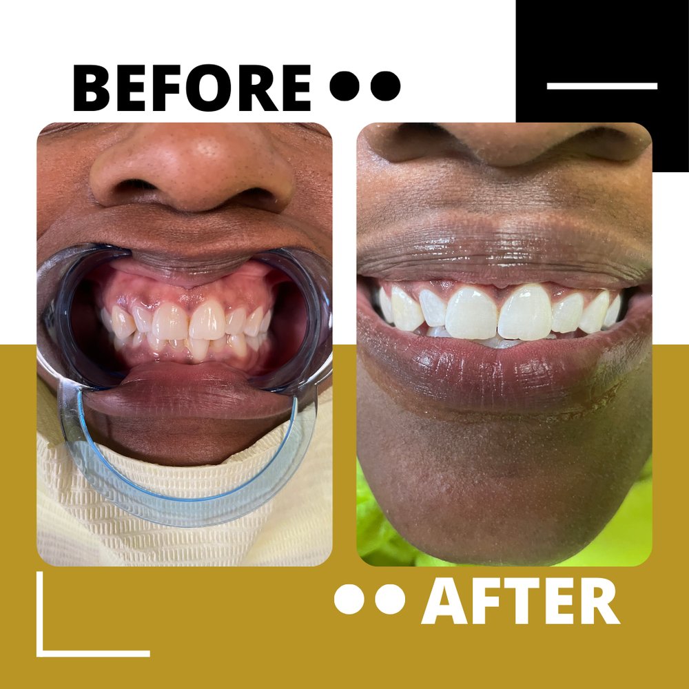 CITY SMILES - Updated July 2025 - Request an Appointment - 408 Station ...