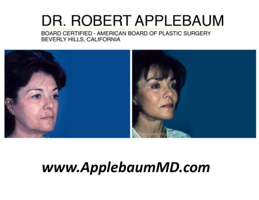 ROBERT APPLEBAUM, MD - Updated December 2025 - 26 Photos & 54 Reviews ...