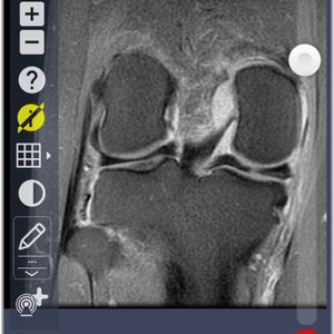 OPEN SYSTEM IMAGING - Updated December 2025 - 23 Reviews - 1401 N ...