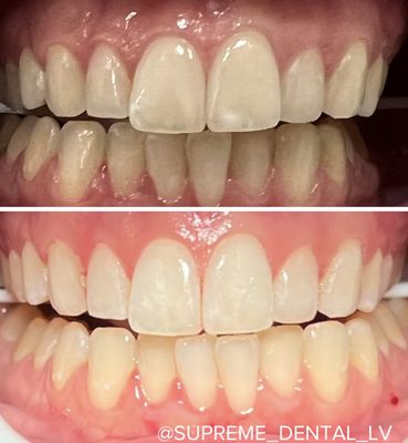 SUPREME DENTAL - Updated July 2025 - 155 Photos & 297 Reviews - 6255 S ...