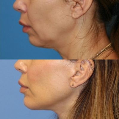 EVAN RANSOM, MD - Updated December 2025 - 126 Photos & 241 Reviews ...