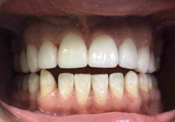 HOWARD A SILVER, DDS - Updated January 2026 - 11 Photos & 67 Reviews ...