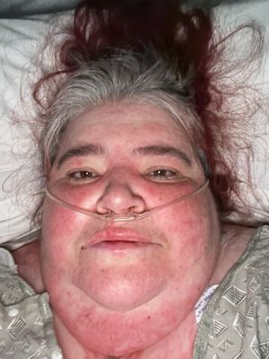 ANTELOPE VALLEY MEDICAL CENTER - Updated January 2026 - 62 Photos & 394 ...