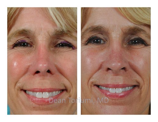 DEAN TORIUMI, MD - Updated August 2024 - 50 Photos & 40 Reviews - 60 E ...