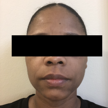 TRIFECTA MED SPA DOWNTOWN - Updated December 2025 - 71 Photos & 88 ...