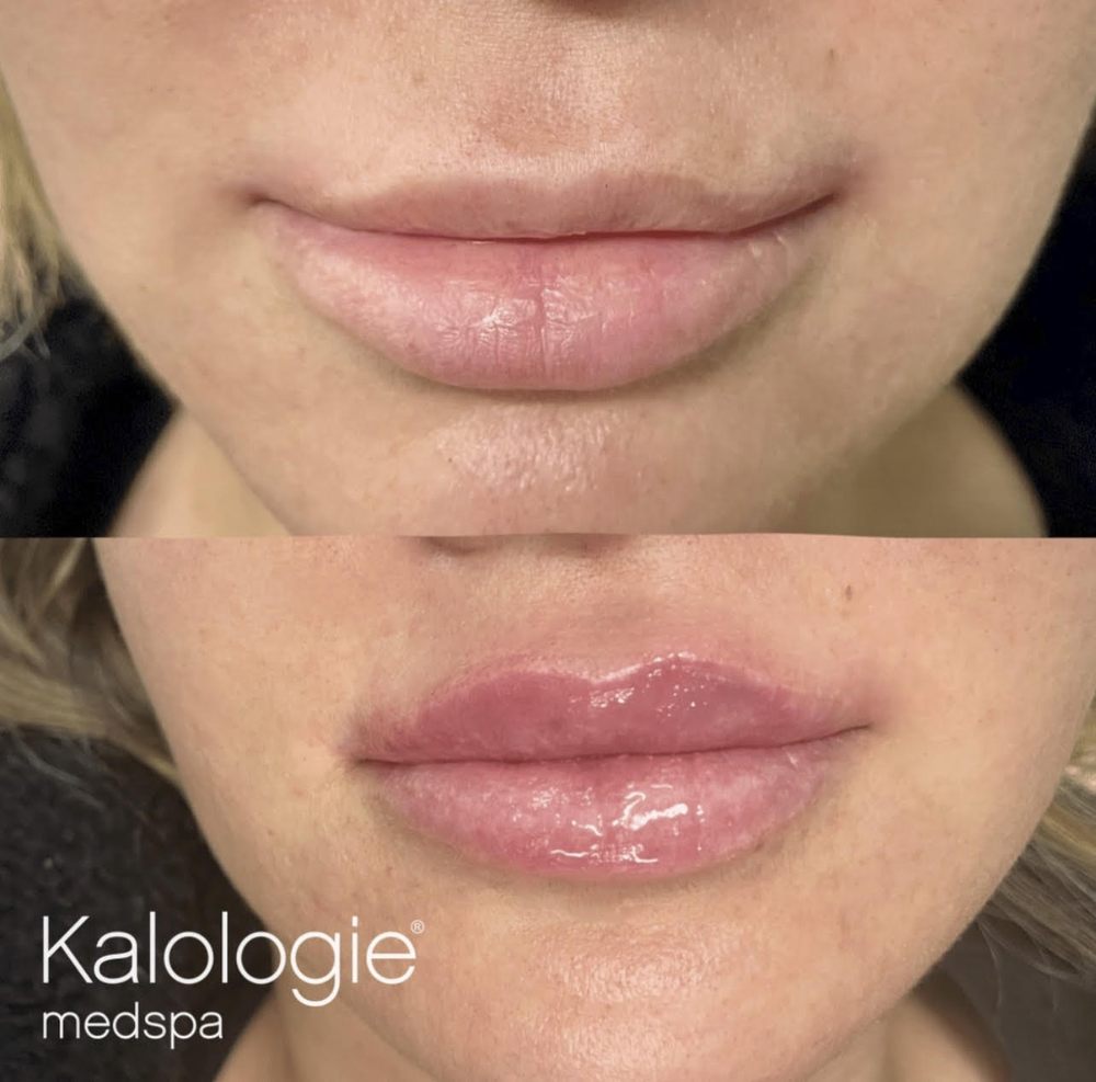 KALOLOGIE MEDSPA SANTA MONICA - Updated December 2025 - 13 Photos ...