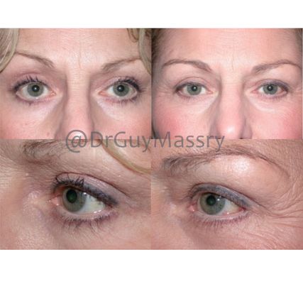 GUY MASSRY, MD - Updated December 2025 - 154 Photos & 176 Reviews - 150 ...