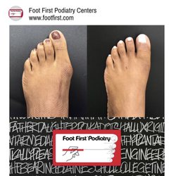 FOOT FIRST PODIATRY CENTERS - 114 Photos - 30 S Michigan Ave, Chicago ...