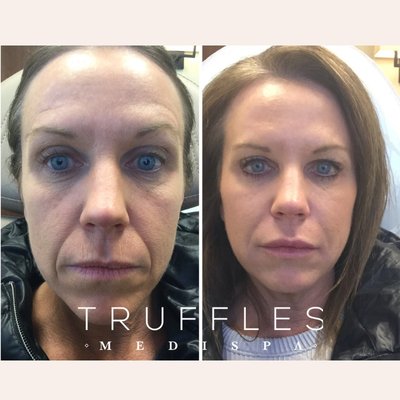 TRUFFLES AESTHETICS - Updated January 2026 - 11 Photos - 86 Vinings Dr ...