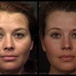 REBECCA FITZGERALD MD - 34 Photos & 163 Reviews - 321 N Larchmont Blvd ...