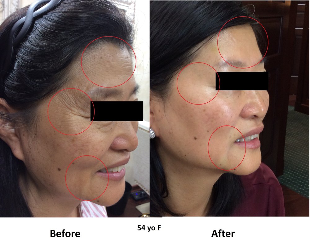 AGELESS FACIAL PLASTICS ASSOC. - 35 Photos - 2124 Oak Tree Rd, Edison ...