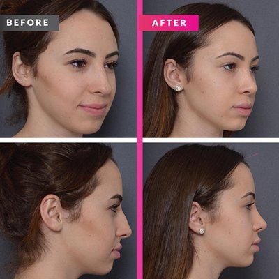 CG COSMETIC SURGERY near you at 2601 SW 37th Ave, Miami, Florida - 238 ...