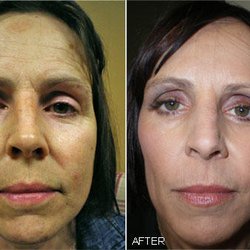 HELENDALE DERMATOLOGY & MEDICAL SPA - 50 Photos & 14 Reviews - 500 ...