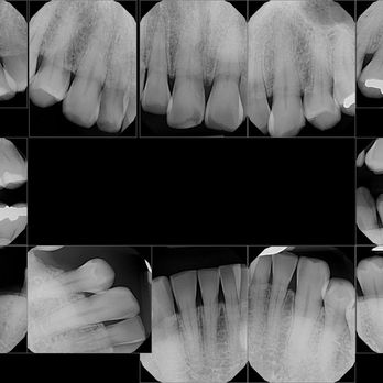 CARSON DENTAL DESIGNS - Updated December 2025 - 13 Photos & 26 Reviews ...