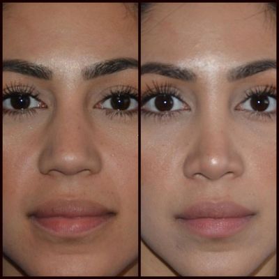 ASHKAN GHAVAMI, MD - Updated December 2025 - 242 Photos & 165 Reviews ...