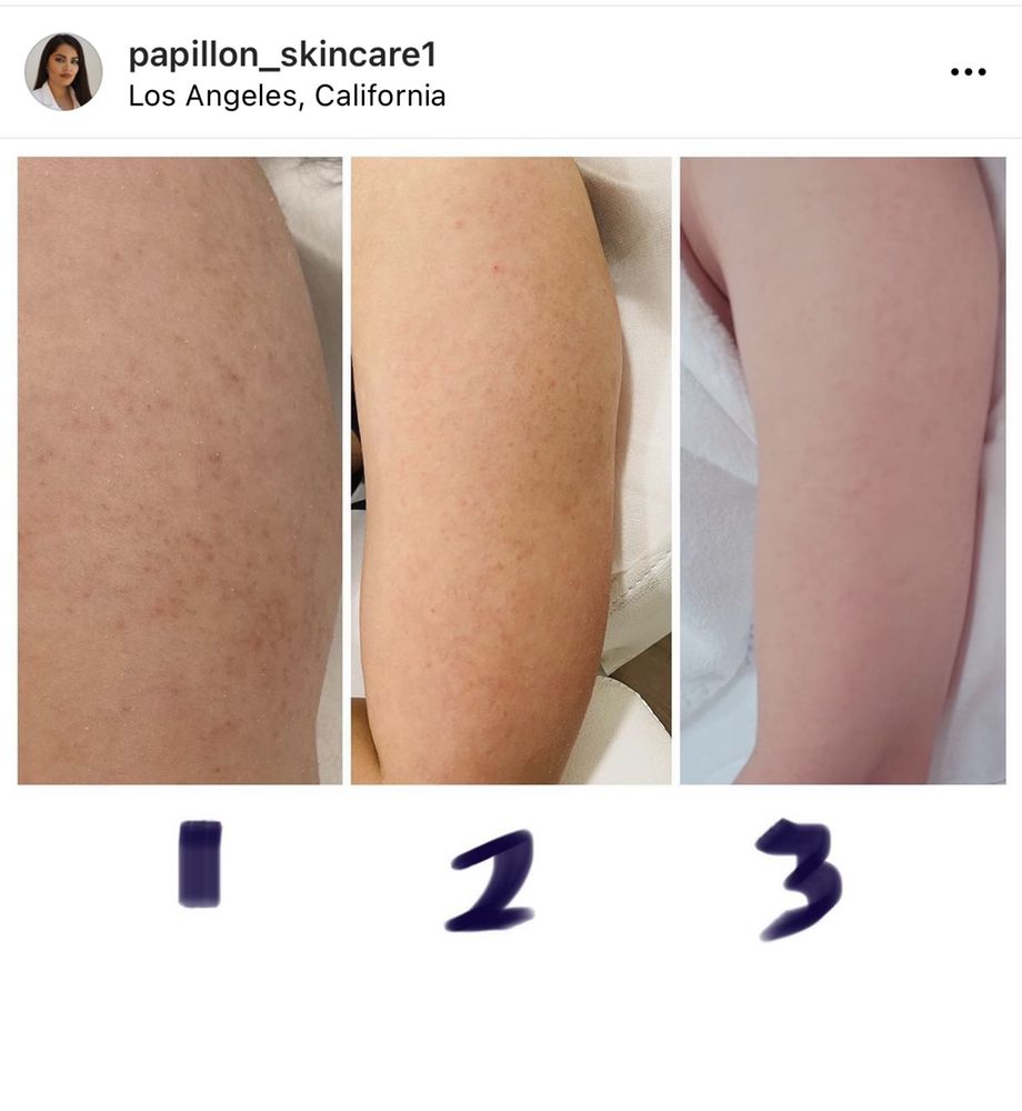 PAPILLON SKIN CARE - 20969 Ventura Blvd, Woodland Hills, California ...