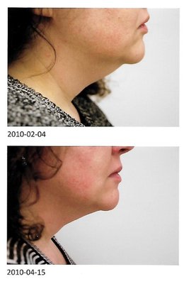 EDWARD STOLAR, MD - Updated September 2025 - 139 Photos & 95 Reviews ...