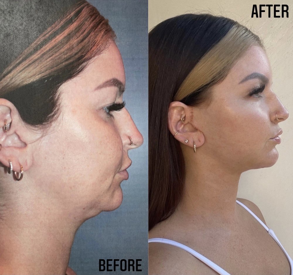 SCOTTSDALE PLASTIC SURGEONS - Updated April 2025 - 12 Photos & 13 ...
