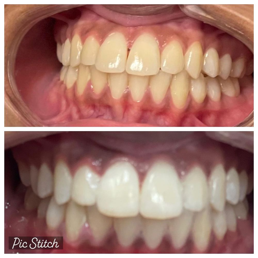 THE S---E B-R - Updated July 2024 - 500 W Germantown Pike, Plymouth ...