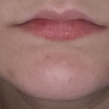 SUGENE KIM, MD FACS - SGK PLASTIC SURGERY - Updated December 2024 - 17 ...