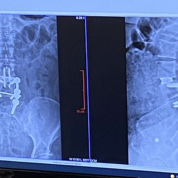 ERIK C SPAYDE, MD - Updated November 2025 - 18 Photos & 43 Reviews ...