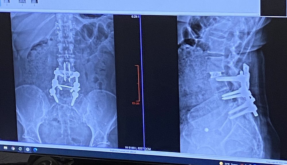 ERIK C SPAYDE, MD - Updated May 2025 - 18 Photos & 42 Reviews - 558 St ...