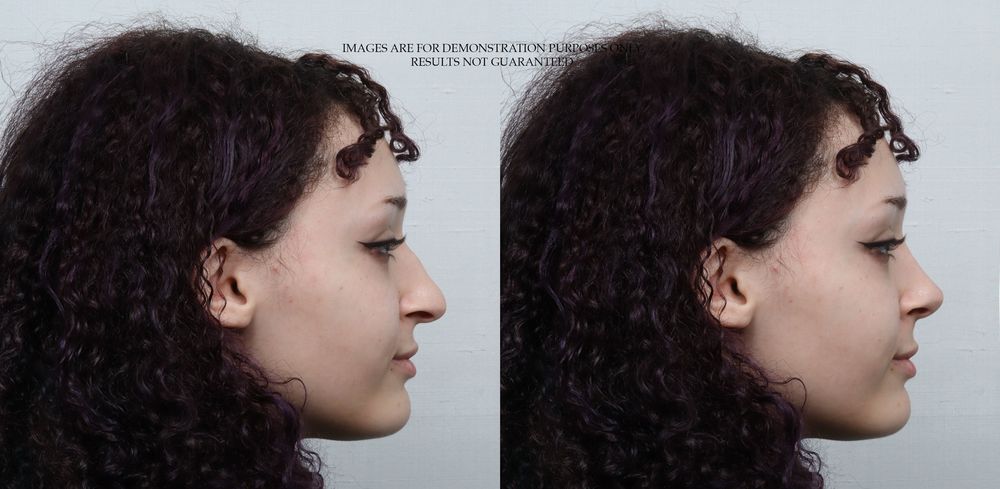 EOS REJUVENATION - Updated January 2026 - 193 Photos & 168 Reviews ...