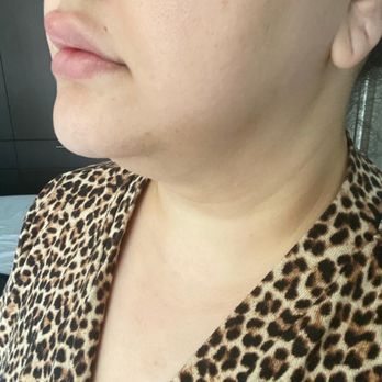 PAUL S THESIGER, MD - THESIGER PLASTIC SURGERY - Updated December 2025 ...