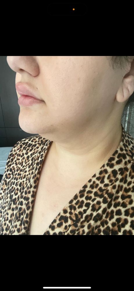 PAUL S THESIGER, MD - THESIGER PLASTIC SURGERY - Updated December 2025 ...