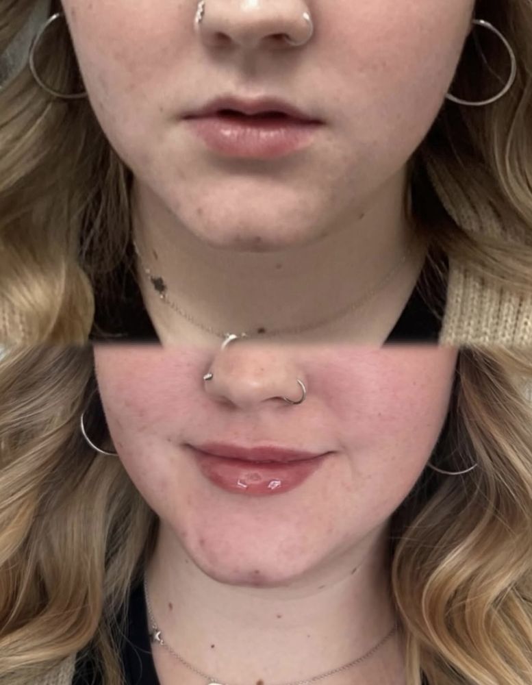 DERMANI MEDSPA - MANSFIELD - Updated October 2025 - 20 Photos - 620 ...