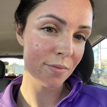 GLO MED SPA AUSTIN - Updated October 2025 - 101 Photos & 47 Reviews - 9801 Anderson Mill Rd ...