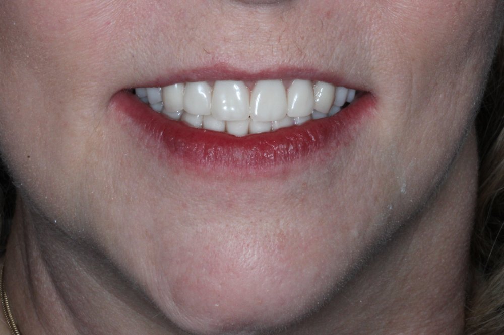 EL DORADO FAMILY DENTAL - Updated June 2024 - 31 Photos & 33 Reviews ...