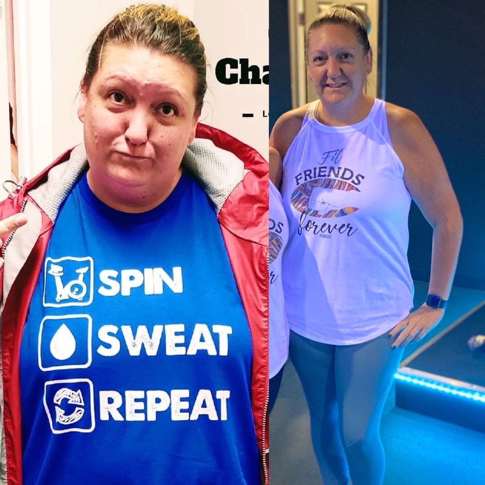 BOLLING PLASTIC SURGERY - Updated February 2025 - 1035 Temple Ave N ...