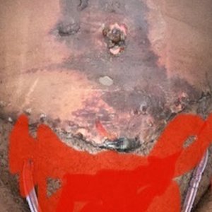 JIMMY S. FIROUZ, MD, FACS - 164 Photos & 351 Reviews - 416 N Bedford Dr ...