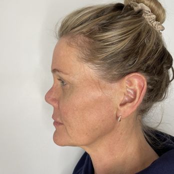 DRMICHAELKIM FACIAL PLASTIC SURGERY - Updated January 2026 - 45 Photos ...