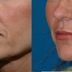 NAFICY PLASTIC SURGERY & REJUVENATION CENTER - 64 Photos & 169 Reviews ...