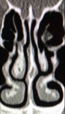 JOSEPH R RAVIV, MD - Updated October 2025 - 16 Photos & 24 Reviews ...