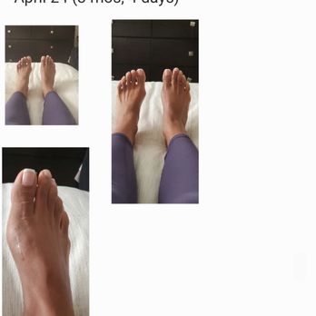 BONINI VINCENT J DPM - Updated September 2025 - 10 Reviews - 2280 Opitz ...