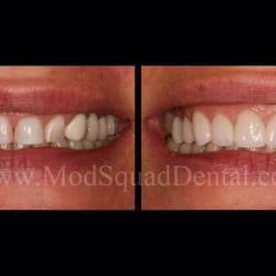 MOD SQUAD DENTAL - 74 Photos & 94 Reviews - 10755 Scripps Poway Pkwy ...