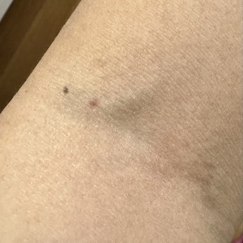 LABCORP - Updated January 2026 - 17 Photos & 35 Reviews - 4300 Rose Dr ...